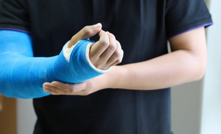 Splint vs. Cast | Emerald Coast Urgent Care